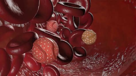 30 Facts About Lipoprotein Disorder