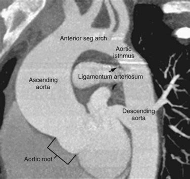 Arterial Anatomy Of The Thorax Radiology Key