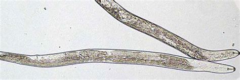 Potato Ditylenchus Spp And Other Migratory Nematodes