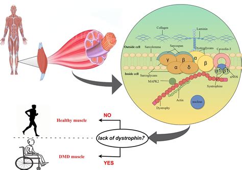 Duchenne Muscular Dystrophy