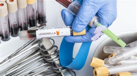 What You Need To Know About Legionella Testing In Uae Expert Advice