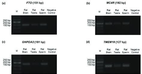 Identification Of Orgs Transcripts In Rats Testes And Sperm By