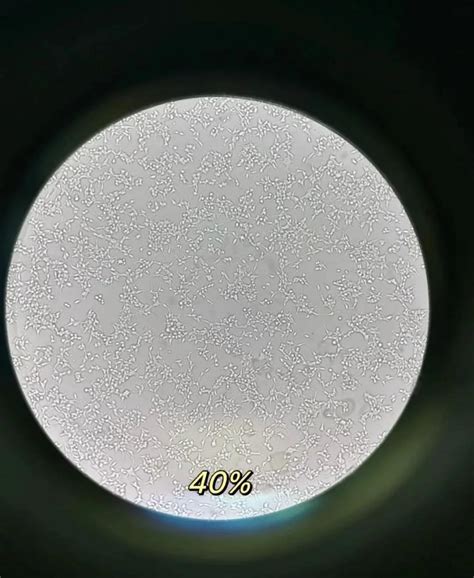 细胞密度对照图