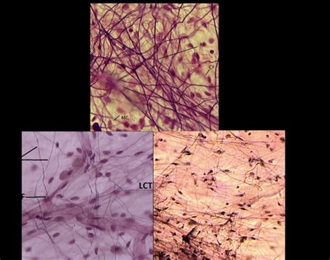 Connective Tissue Subtypes Functions And Locations Flashcards Quizlet