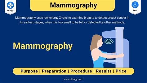 Top Mammography Keywords Test Blogs Drlogy