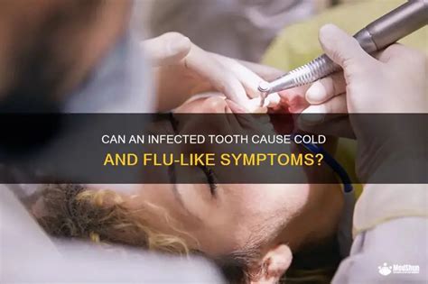 Can An Infected Tooth Cause Cold And Flu Like Symptoms Medshun
