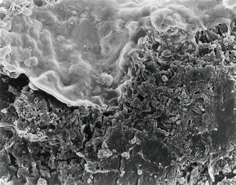 Human Tooth With Plaque And Tartar 1 Photograph By Science Photo