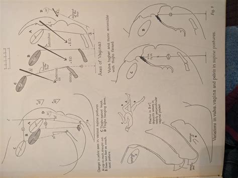 Human Sex Anatomy A Topographical Hand Atlas Second Edition Robert
