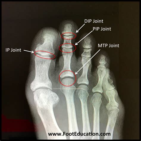 Joint Foot Anatomy What To Know About Foot Anatomy Hxdz