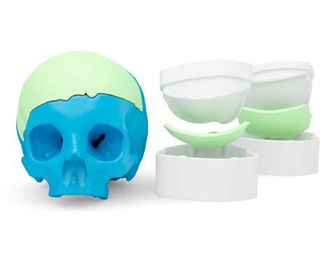 Cranial Reconstruction Tecumed Sro