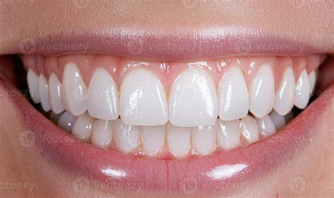 Close Up Of A Perfect Smile With Healthy White Teeth 55620923 Stock