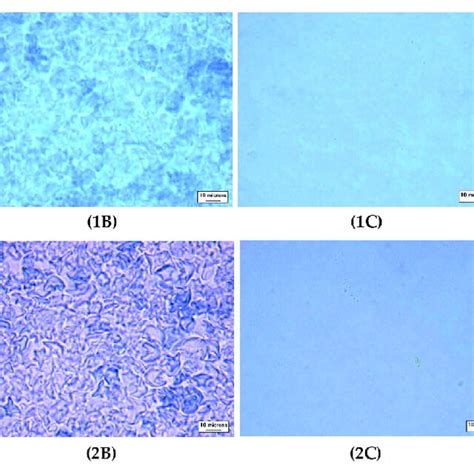 Microstructure Of Cooked Starch Pastes Rva Preparation 40× Bar 10