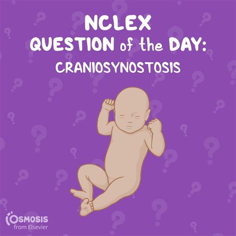 Nclex Rn® Question Of The Day Craniosynostosis Osmosis Blog