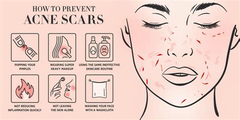 The 6 Mistakes Causing Your Acne Scars Averr Aglow®