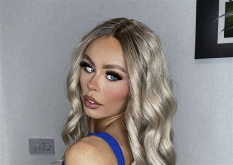 Populer Di Internet Karena Punya Mata Juling Model Ini Ingin Operasi Mata