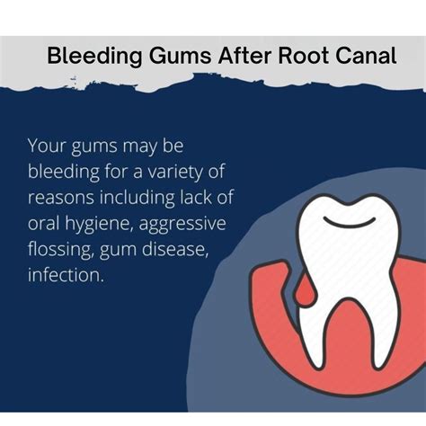 Bleeding Gums After Root Canal Is It Normal Smile Studio Boston