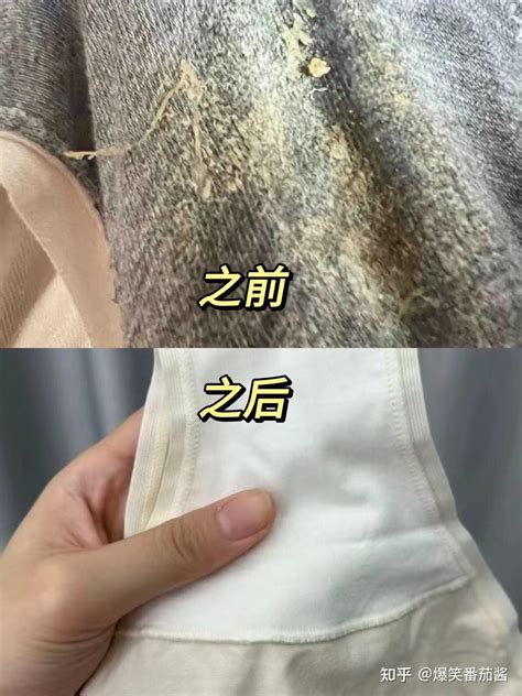 白带出现这3种情况，一定要重视：黄绿分泌物、白带豆腐渣、泡沫分泌物 知乎