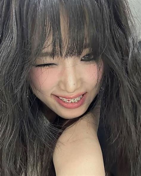 Tooth Gem đang Trở Thành Trend Trong K Biz