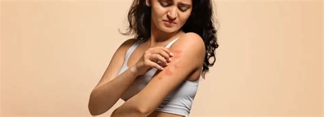 Natural Remedies For Itchy Skin Gp Approved In Australia