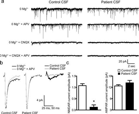 Patients Antibodies Selectively Decrease Synaptic Nmda Currents