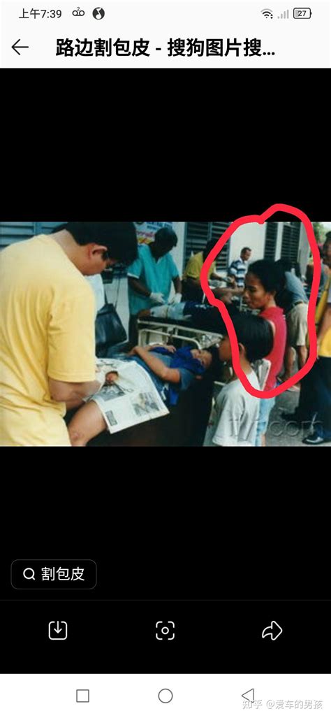 路边割包皮 知乎