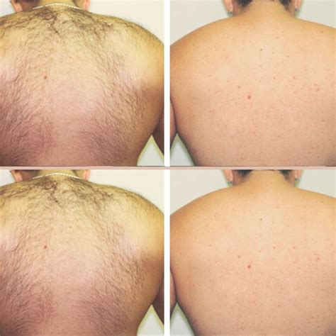 Image Gallery Derma Revive Skin Clinic