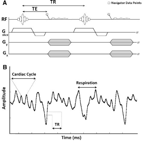 Schematic Of The 2d Self Gated Ute Sequence A Readout Is Performed