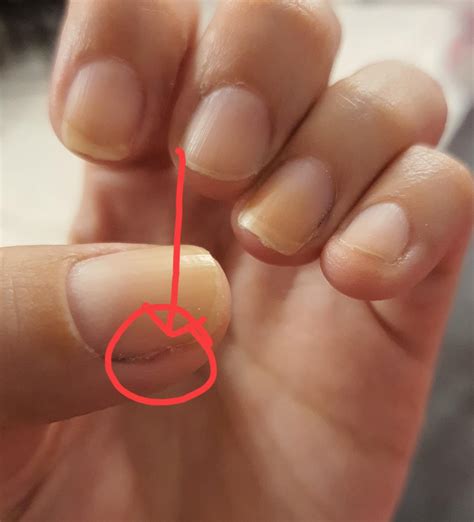 Mi Thumb Nails Always Break At The Same Spot Right In The Middle Of The Nail Bed R