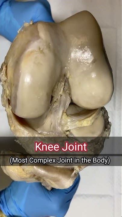 Knee Joint Dissected Most Complex Joint In The Body Anatomy