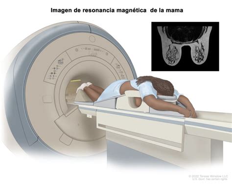 ¿cómo Funciona La Imagen Por Resonancia Magnética