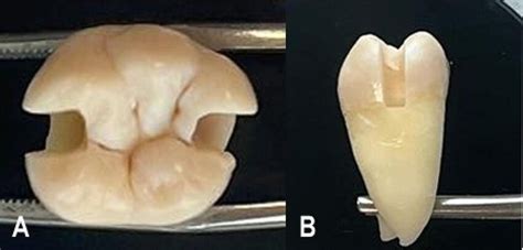 Standardized Class Ii Cavity Preparation A Occlusal View B Aproximal