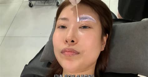 완벽한 이목구비 되고파 이세영 반영구 성형 과정 공개