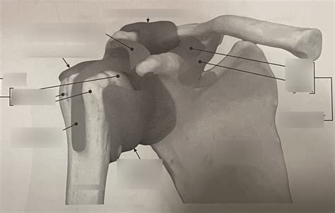 75 Right Shoulder Ball And Socket Joint Anterior Diagram Quizlet