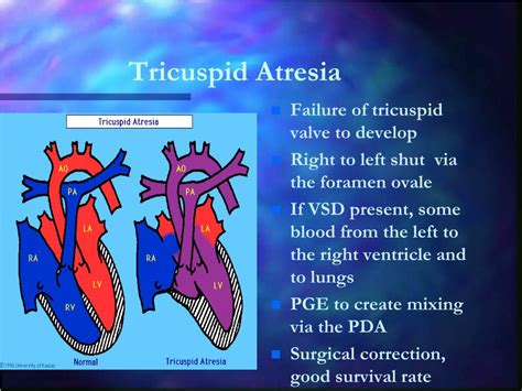 Ppt Neonatal Cardiology Powerpoint Presentation Free Download Id
