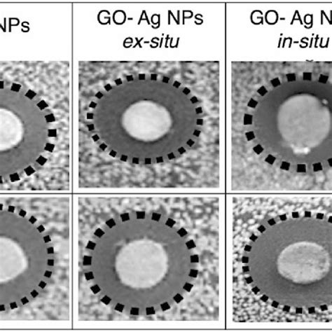 Photographs Of Disk Diffusion Assays With Delimitated Inhibition Zone