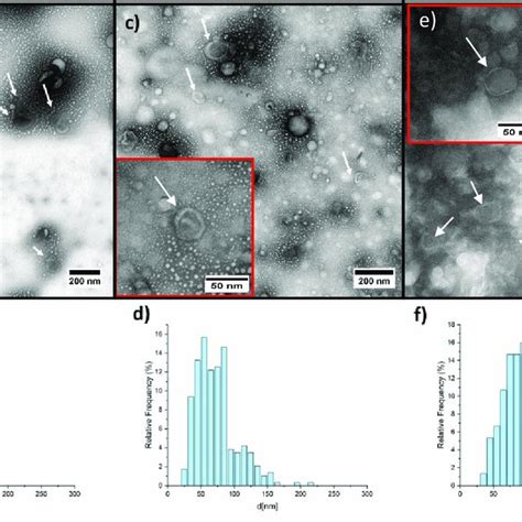 Tem Images And Histogram Of The Relative Frequency Of The Ev Diameters