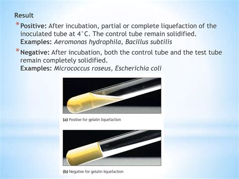 Gelatin Hydrolysis Test Pptx