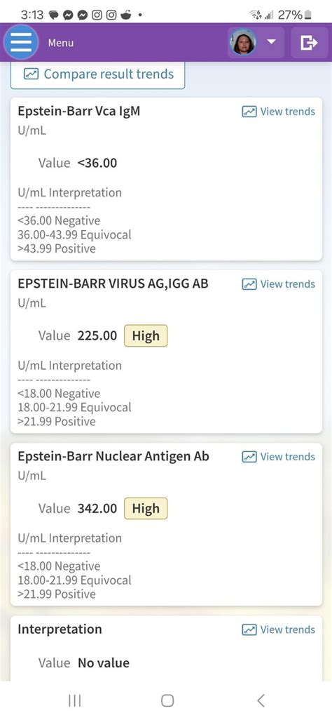 Ebv Test Results R Ebv