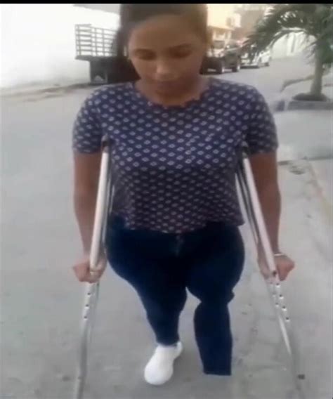 Amputee Empty Pant Leg Video 2