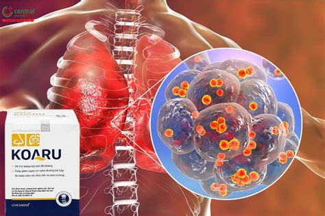 Thuốc Bột Koaru Giảm đề Kháng Giảm Viêm đường Hô Hấp