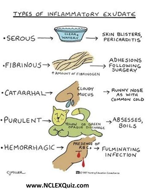 Nursing Study Guide 5 Types Of Inflammatory Exudate Nclex Quiz