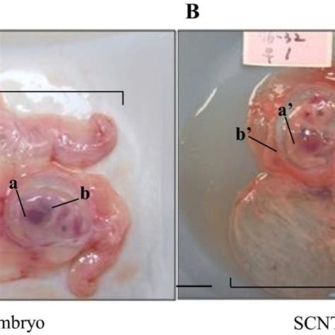 Morphology Of Fetus And Extraembryonic Tissues In The Control And