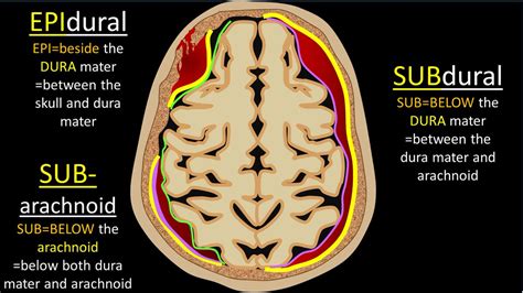 1radiologist Not Answering The Phonejust Want A Quick Read On That