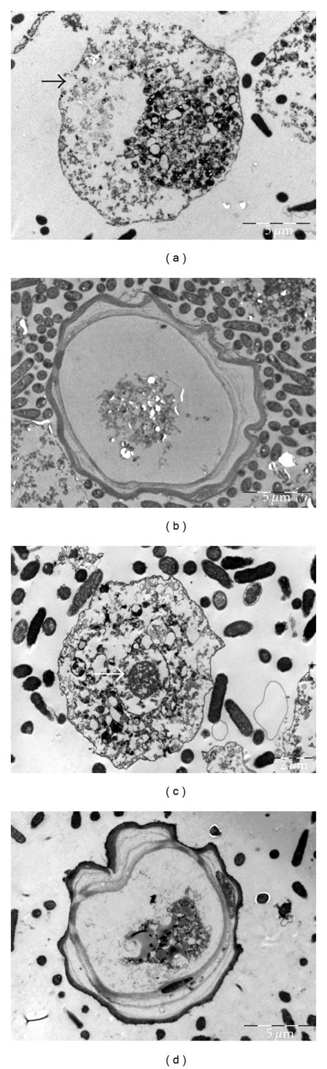Electron Microscopy At 37°c Black Arrows Point Out Necrosis And White