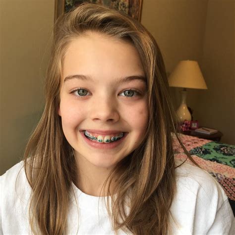 Braces Girls Brace Face Bubblegum Pop Whitney Long Hair Styles