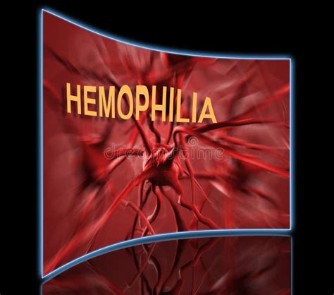 Hemophilia Stock Illustration Illustration Of Microbiology 49012812