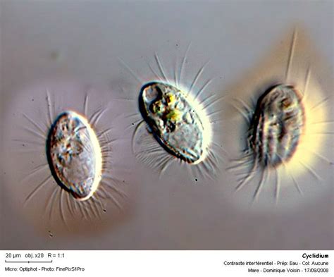 Cyclidium Sp Ciliés Mikroscopia