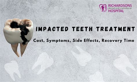 What Does An Impacted Tooth Feel Like At Milla Slessor Blog