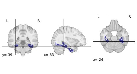 Fmri Demo Nilearn Version — Rsatoolbox 021dev86 Documentation