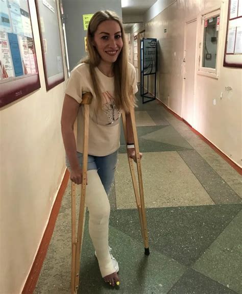 Pin By Michael Bierbaum On Leg Casts Leg Cast It Cast Broken Arm